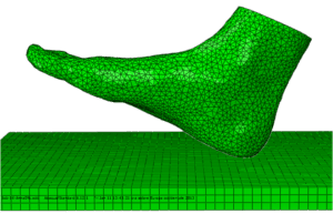 Gait Simulation: Exploring Biomechanical Consequences of Surgeries