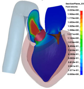 The Role of Simulation in Cardiovascular Devices